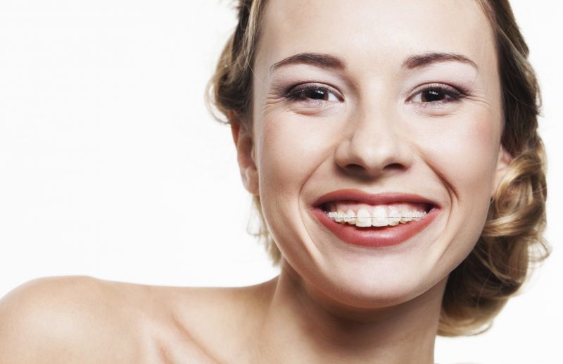 Types of Braces - Shawnee Orthodontics